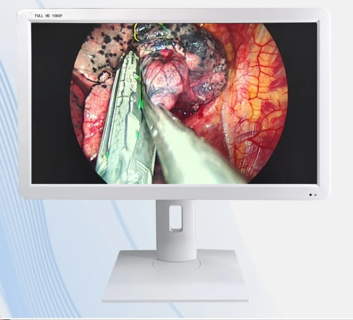 32-Inch Medical Grade Monitor for Endoscopic Procedures Electric Power ...