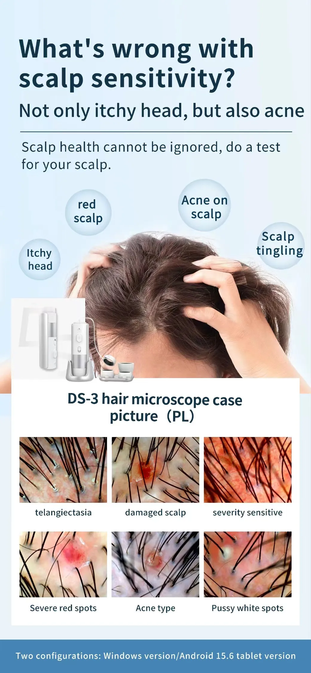 Physiotherapy Equipment Hair Follicle Scalp Microscope Detector Scalp ...