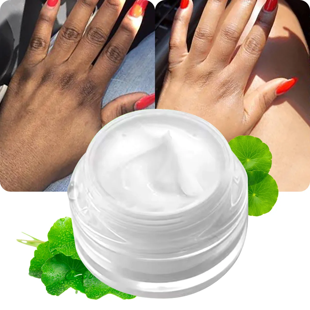 Niacinamide Dark Knees Knuckles Elbows Armpit Whitening Cream Woman ...