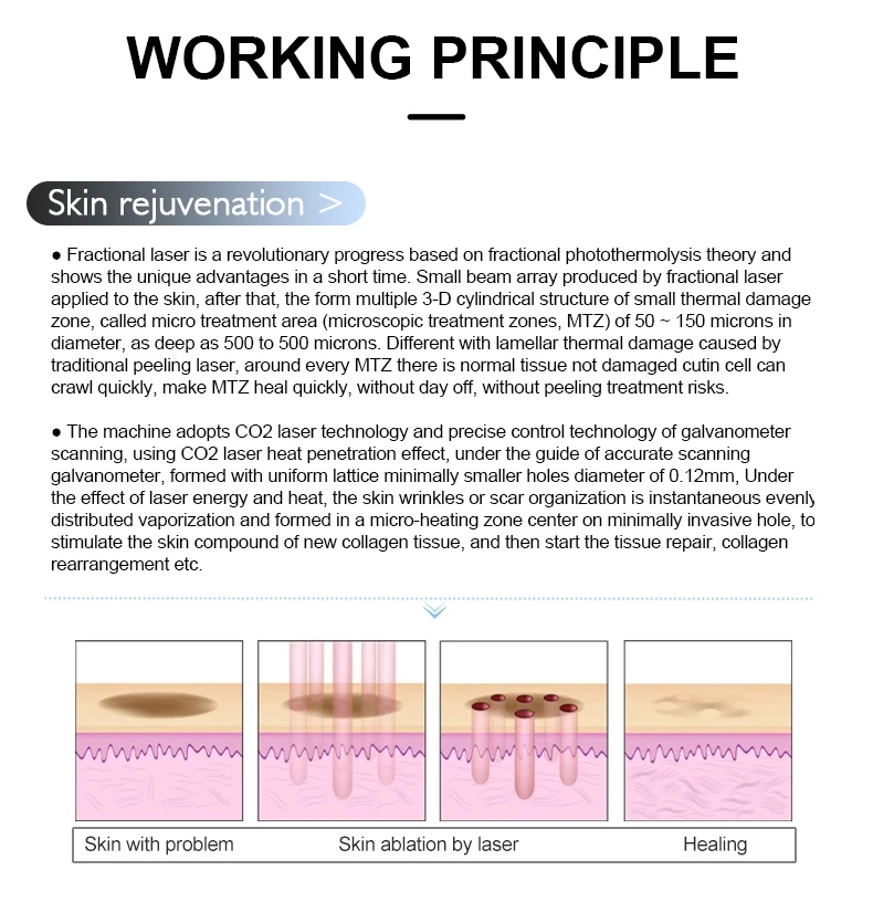 High Quality Acne Treatment Co2 Fractional Laser Machine/scars Removal ...