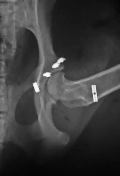 Titanium Anchors for Ligament Joint Repair - Durable Orthopedic ...