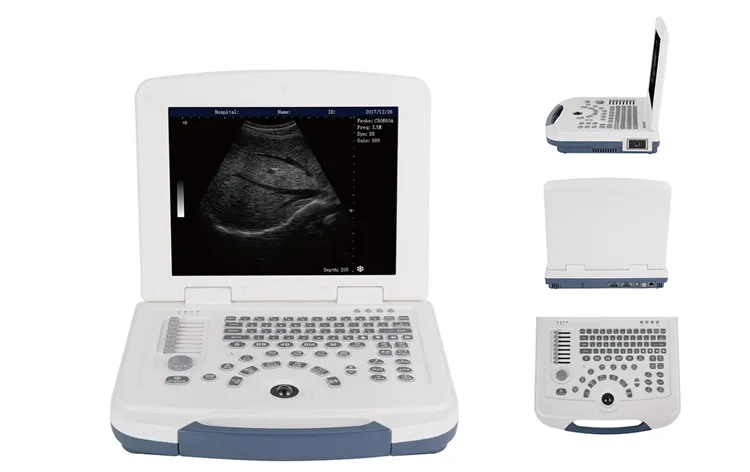 Cow Laptop Ultrasound Horse Sonar Scanner Rectal Probe Pregnancy Tester ...