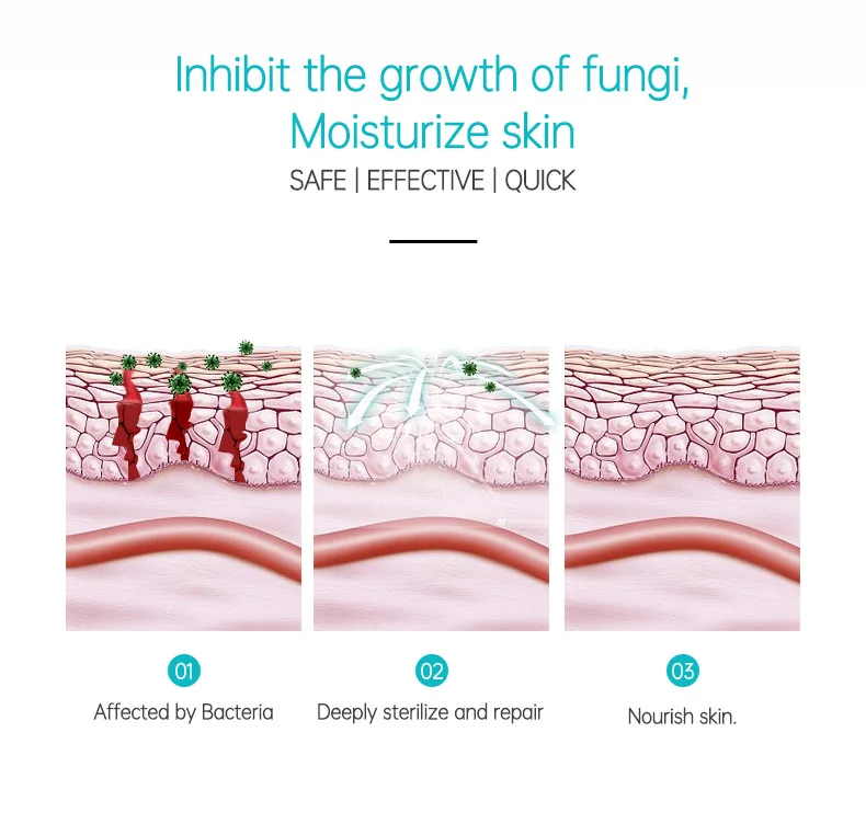 Skin Pruritus Ointment Skin Ringworm Wang Ointment Dispel Psoriasis ...