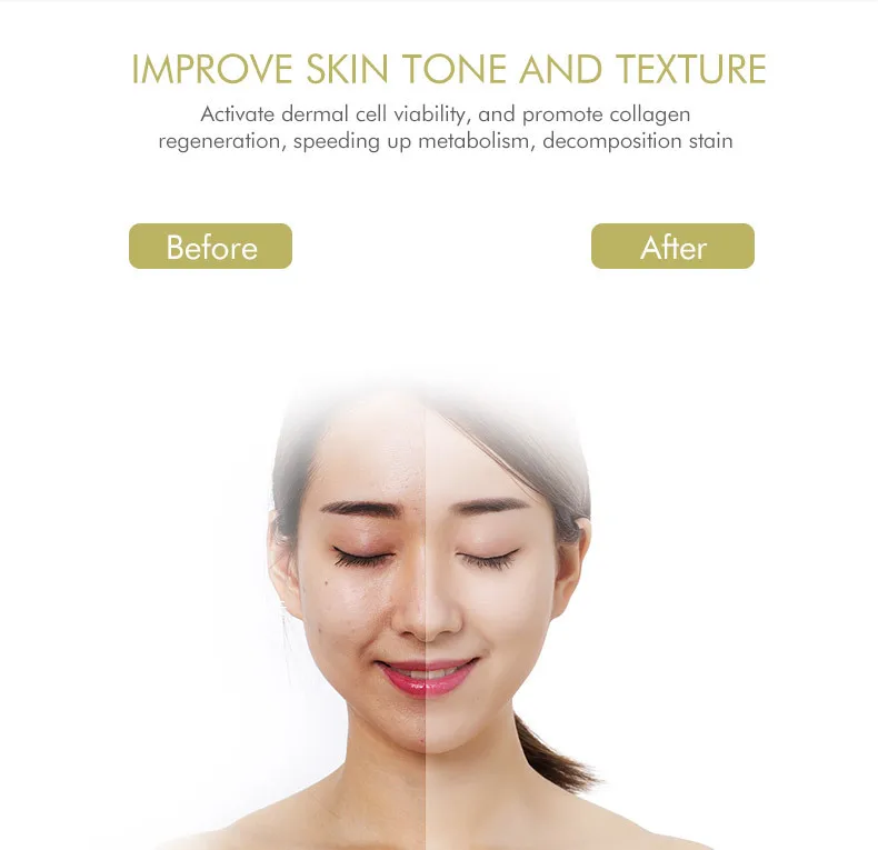 AOSO Facial Massager - Intelligent Metal Guide Head Skin Rejuvenation ...