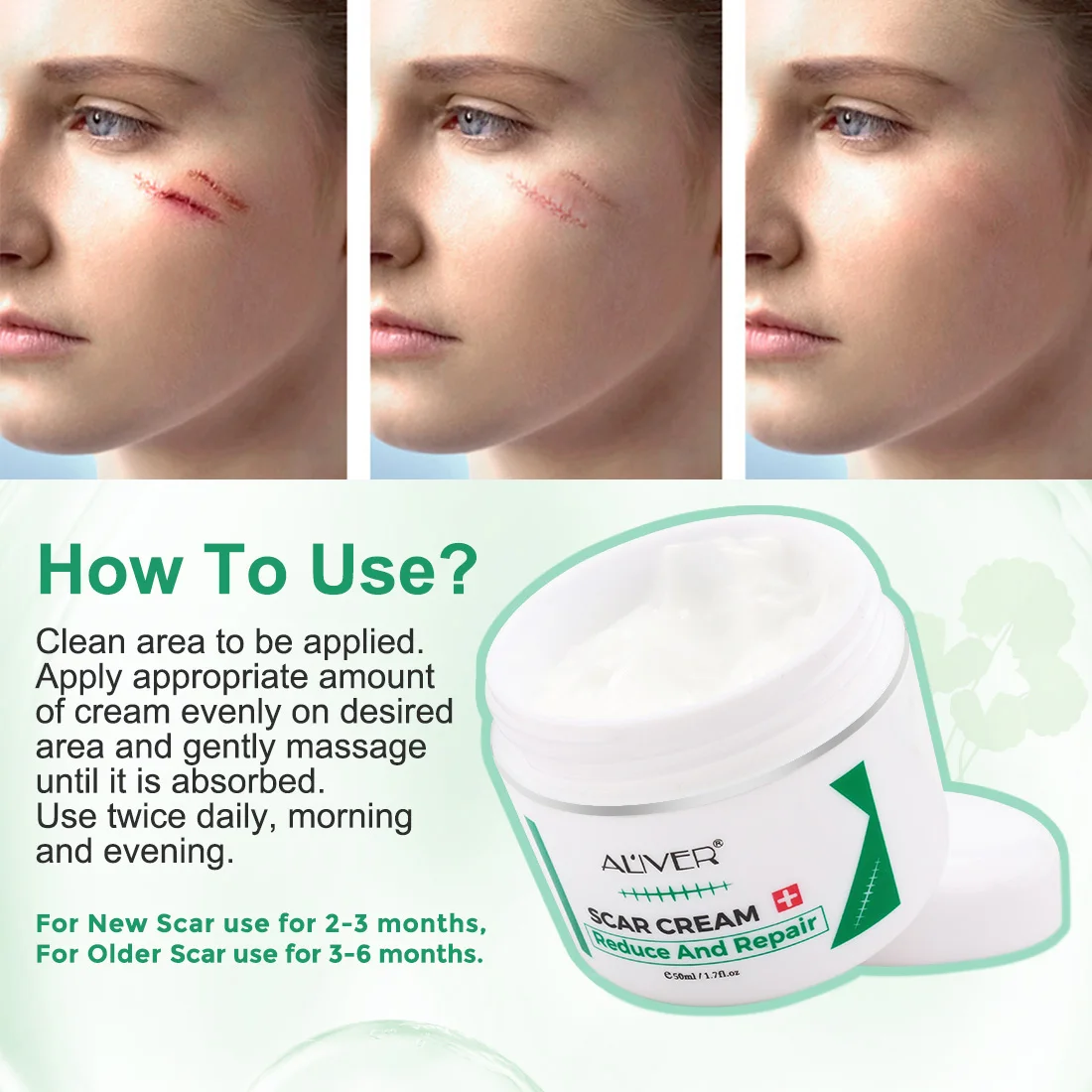ALIVER Scar Cream for Old Scars - Natural Stretch Mark Removal and Skin ...