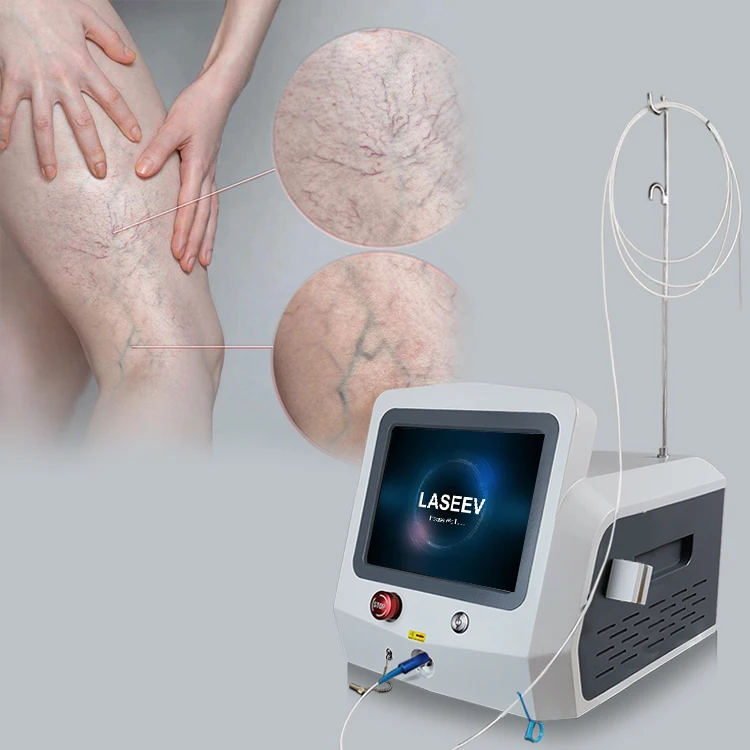 EVLT/EVLA Endovenous Laser Ablation Varicose Veins Diode Laser ...