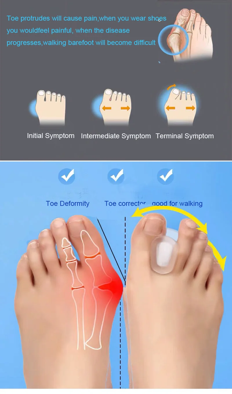 Emy Hallux Valgus Corrector Silicone Gel Toe Separator Bunion Foot Pain ...