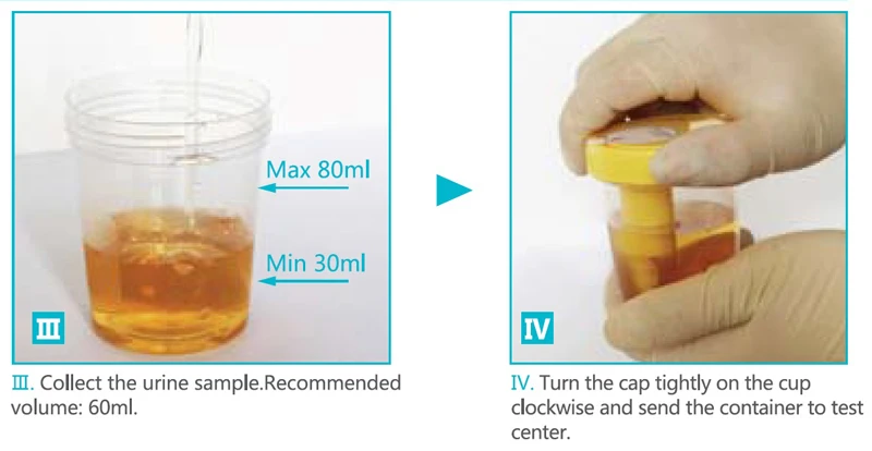 Medical Use Specimen Container 120ml - Urine Collection Cup