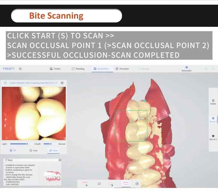 Zahndent 3 Different Tips Autoclavable Intraoral Scanner Cad Cam System ...