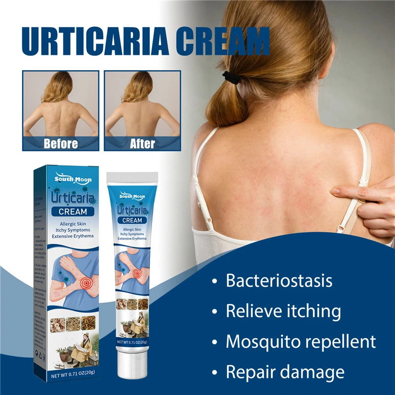 South Moon Urticaria Cream Bacteria Inhibiting Itching Relieving ...