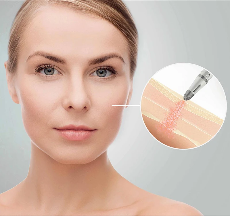 Germany Technology Seyo TDA Mesotherapy No Needle Mesogun