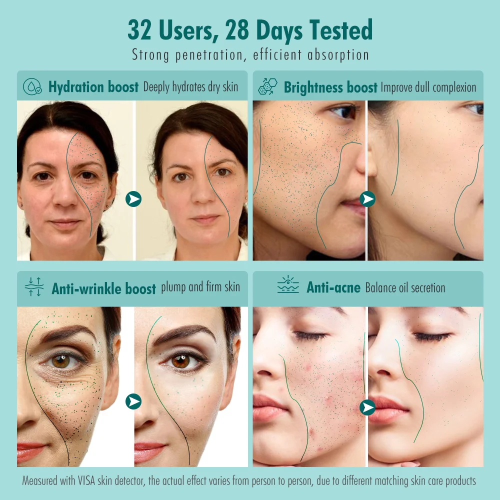 Spa Use Hair Facial Skin Rejuvenation3 In1 Oxgen Facial Machine ...