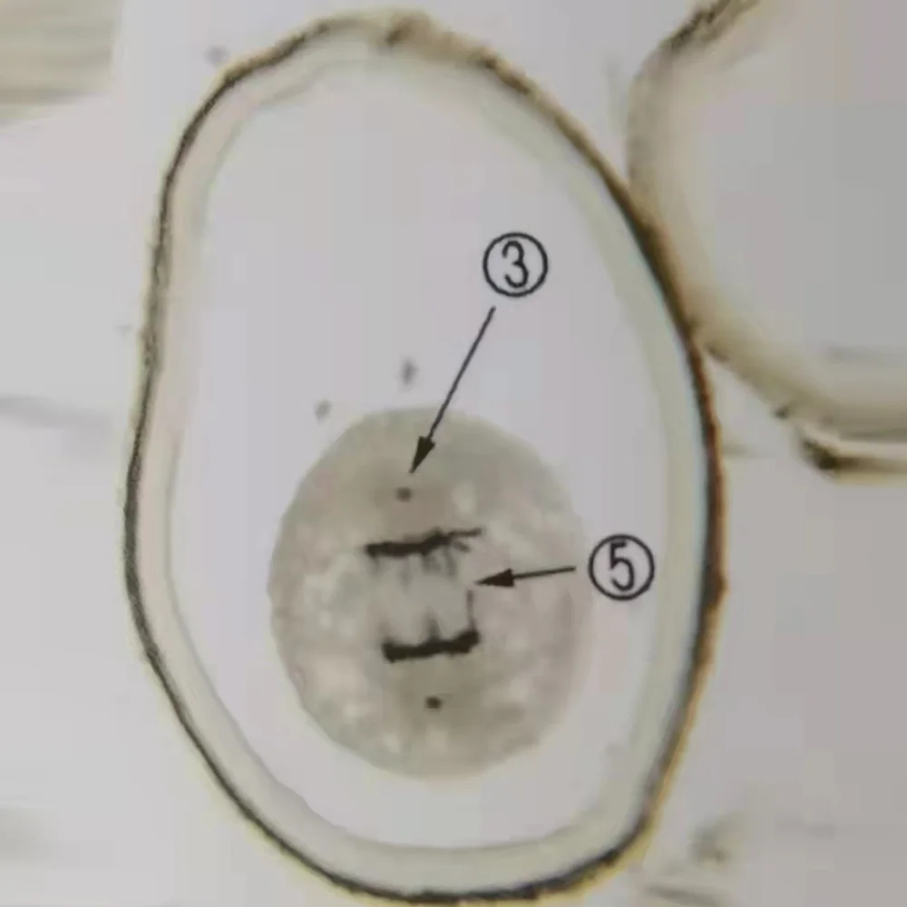 Prepared Microscope Slides: Ascaris Lumbricoides Mitosis for Medical ...