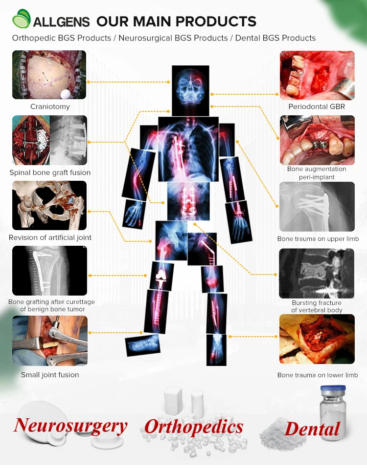 Bone Membrane (GBR) - Absorbable Collagen for Orthopedic Surgery