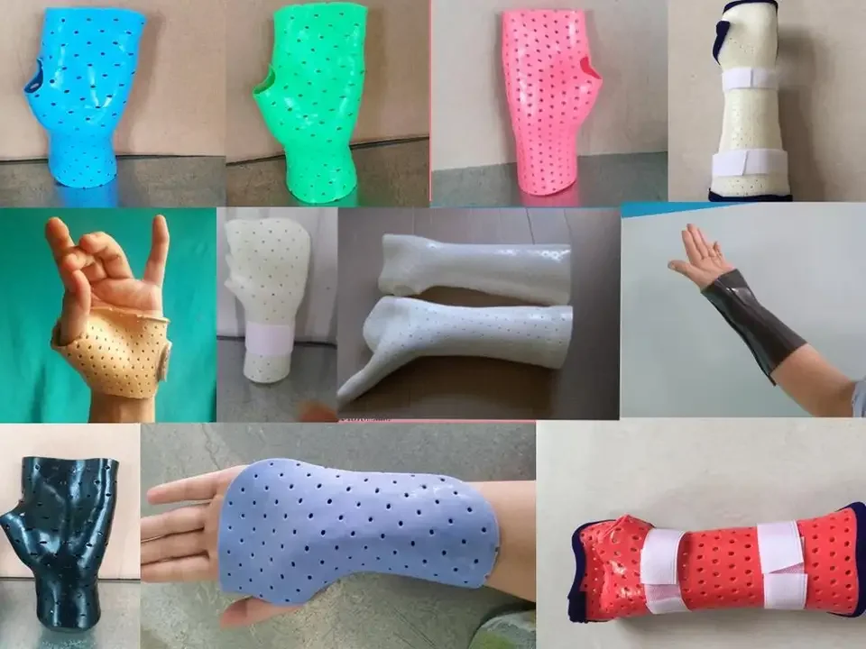 Medical Supply Perforated Splinting Material Thermoplastic Sheet Splint ...
