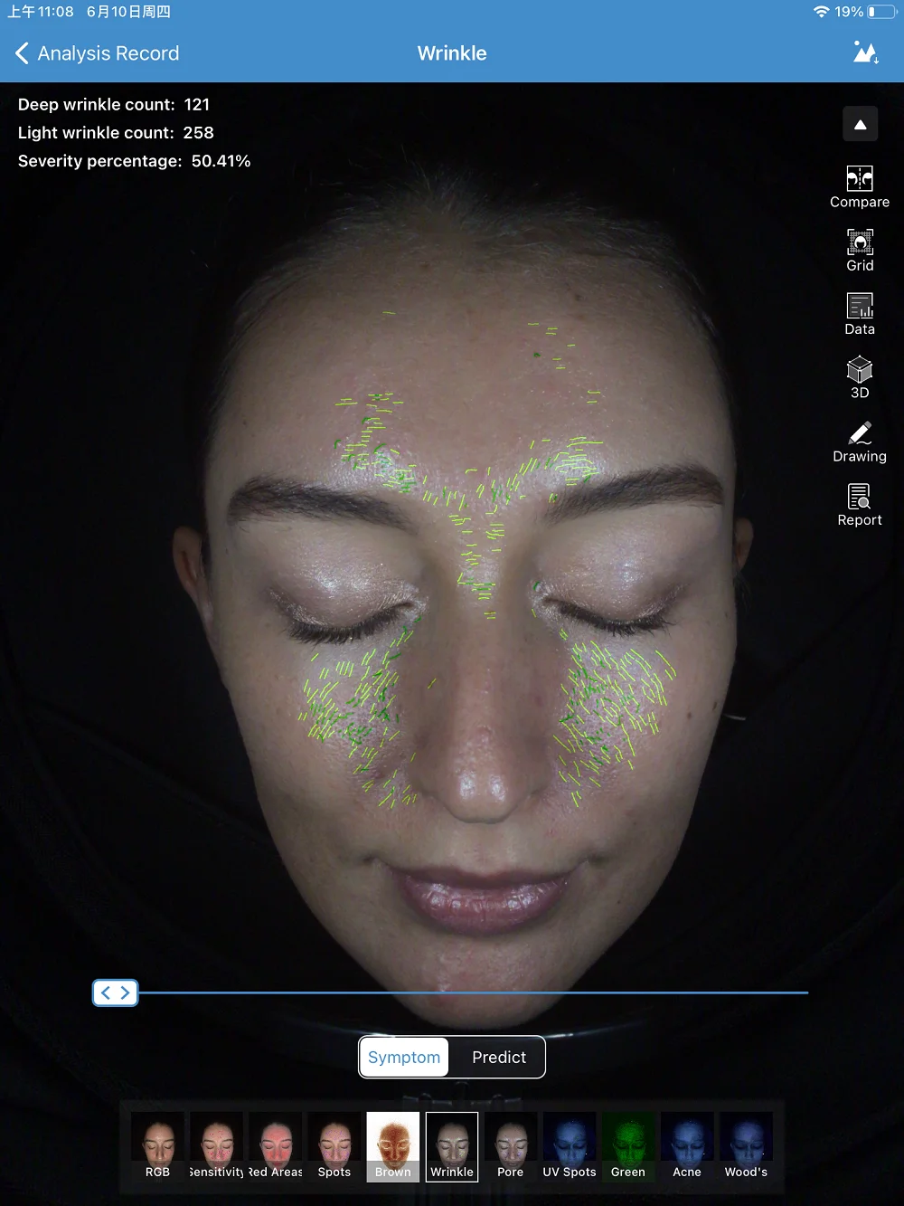 UV Light Facial Skin Scanner - Meicet MC10 Skin Analyzer