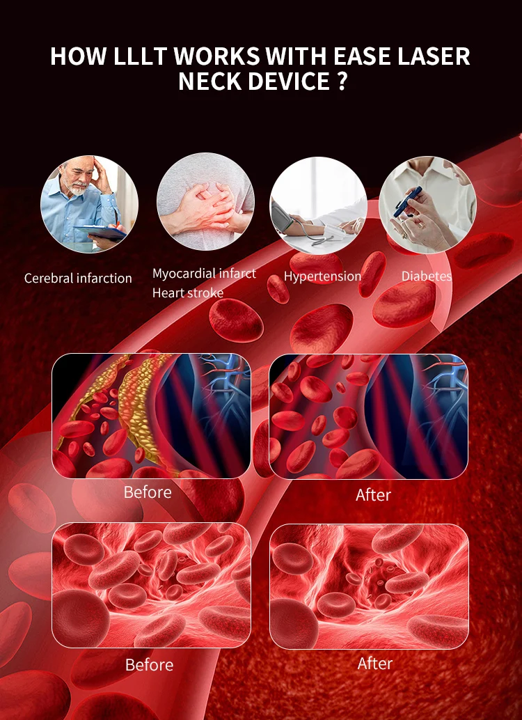 Nasal Rhinitis Red Lights Physiotherapy Equipment Neck Pain Relief ...