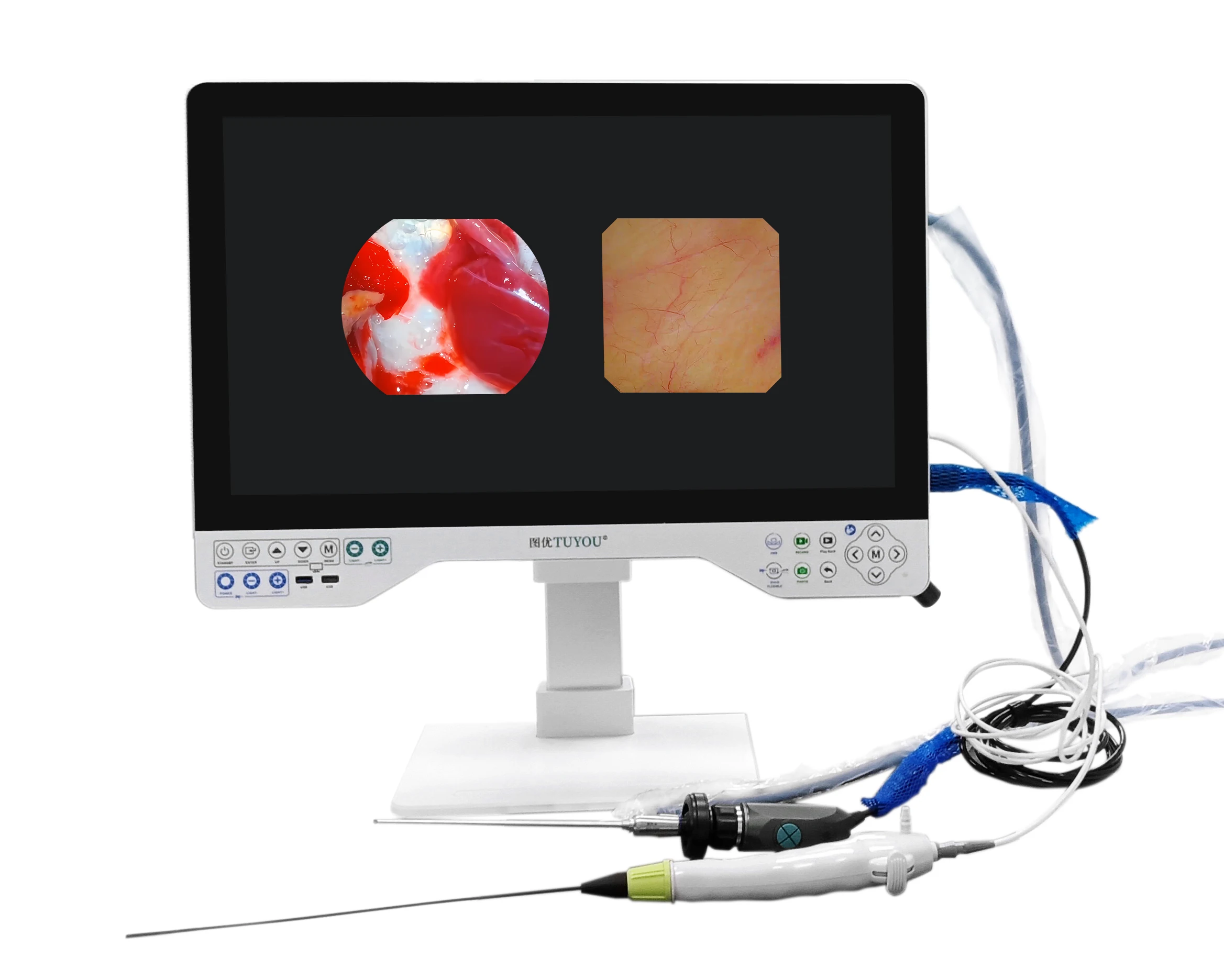 Integrated Video ENT Laparoscope Arthroscope Endoscopy Camera Full Hd ...