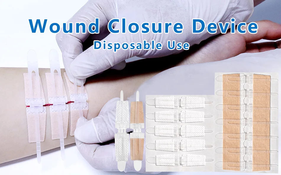 Stitch Free Emergency Wound Closure Device - Konlida
