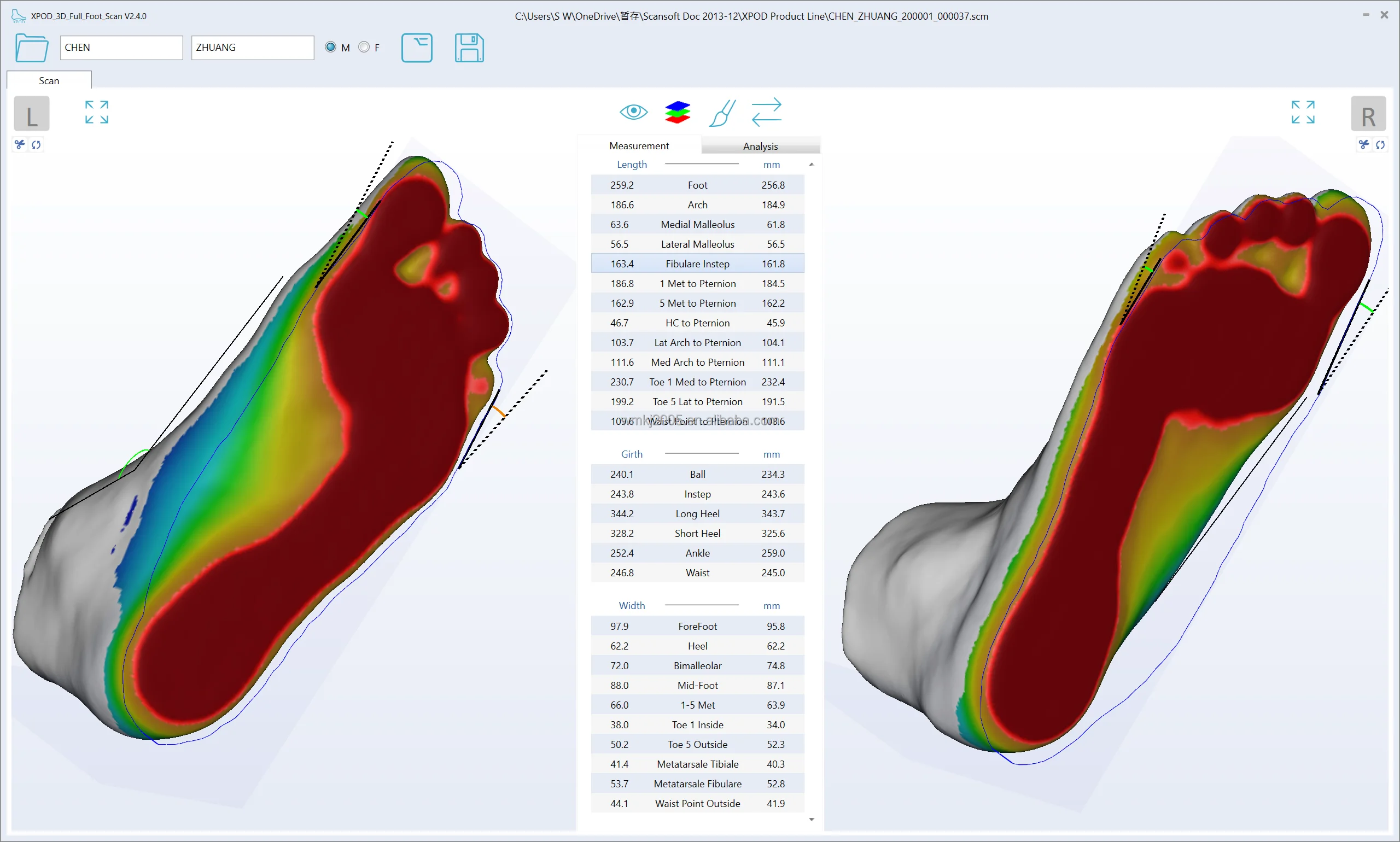 3d Foot Scanner Xpod-ss2 Vismach Diabetic/orthotic Insoles/shoe Last ...