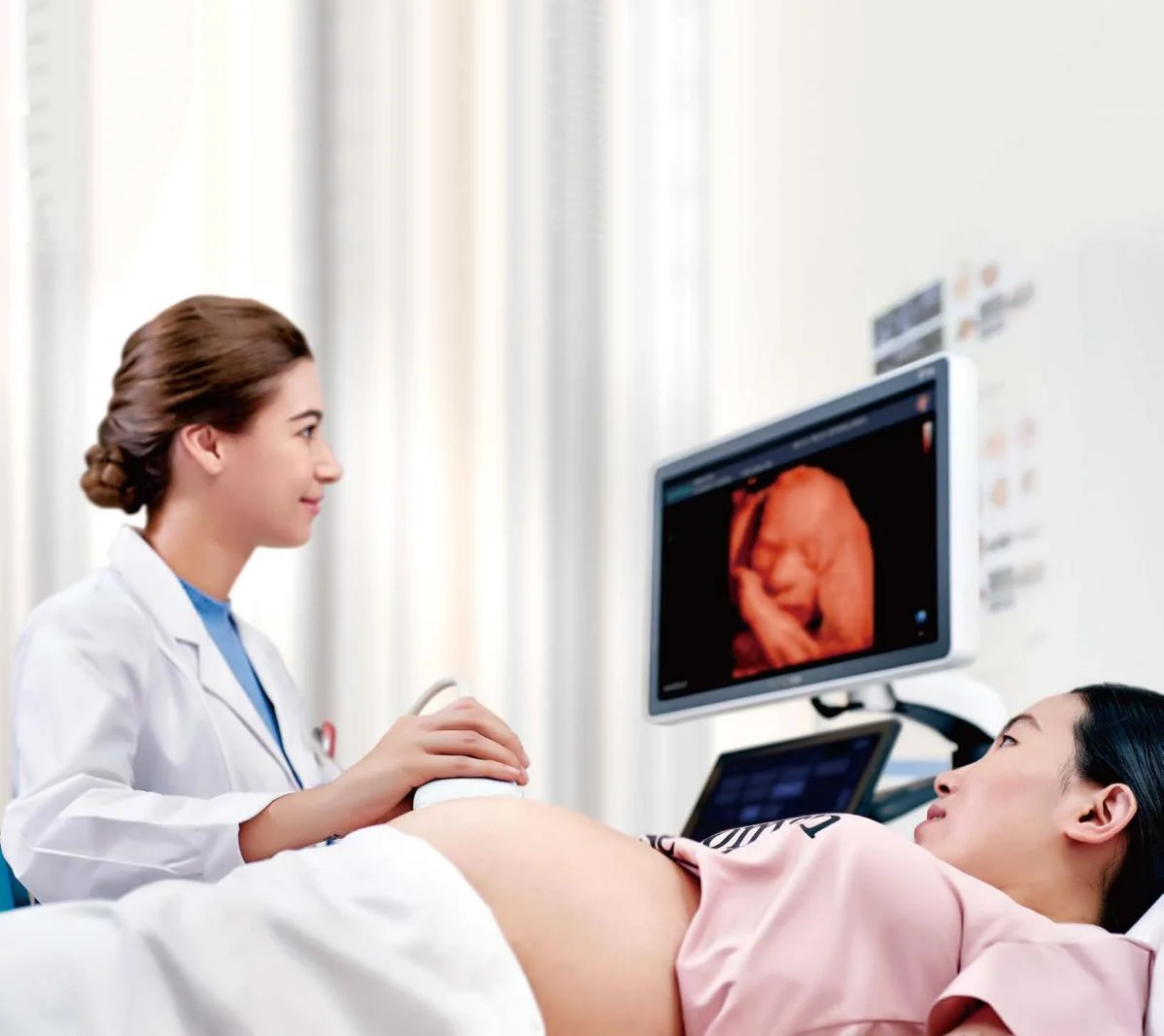 Sonoscape P50 Elite Sonography Ultrasound Echo Machine Hospital Medical ...