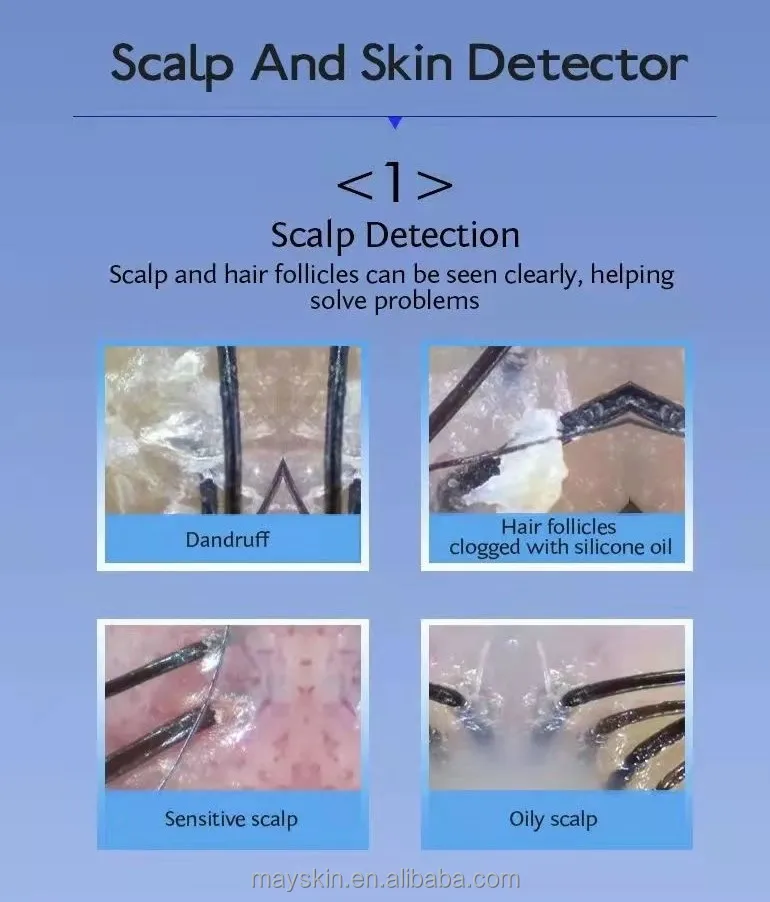 Wireless Hair Scalp Analyser - Smart Skin and Hair Analysis
