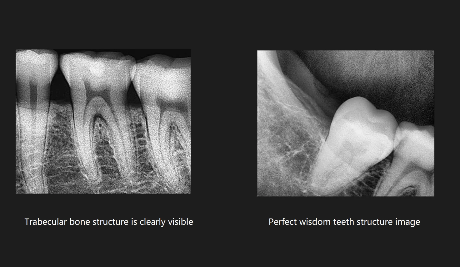 Rvg Digital Oral X-ray Sensor Oral Imaging System Dental X-ray Sensor ...