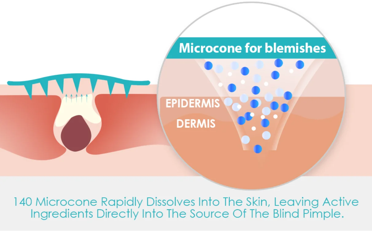 Micro Needling Acne Pimple Patches Hydrocolliod Microneedles Face Patch ...