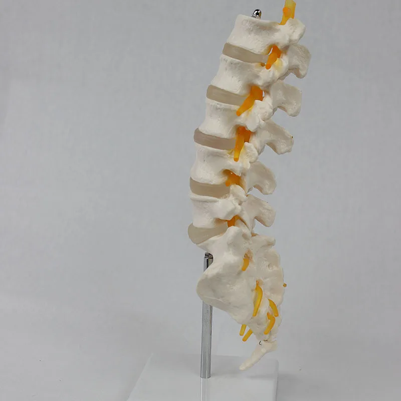 Medical Teaching Lumbar Vertebrae with Sacrum & Coccyx and Herniated ...