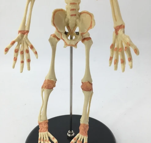 Medical Science Fetal Skeleton Model Human Infant Fetus Newborn Baby ...