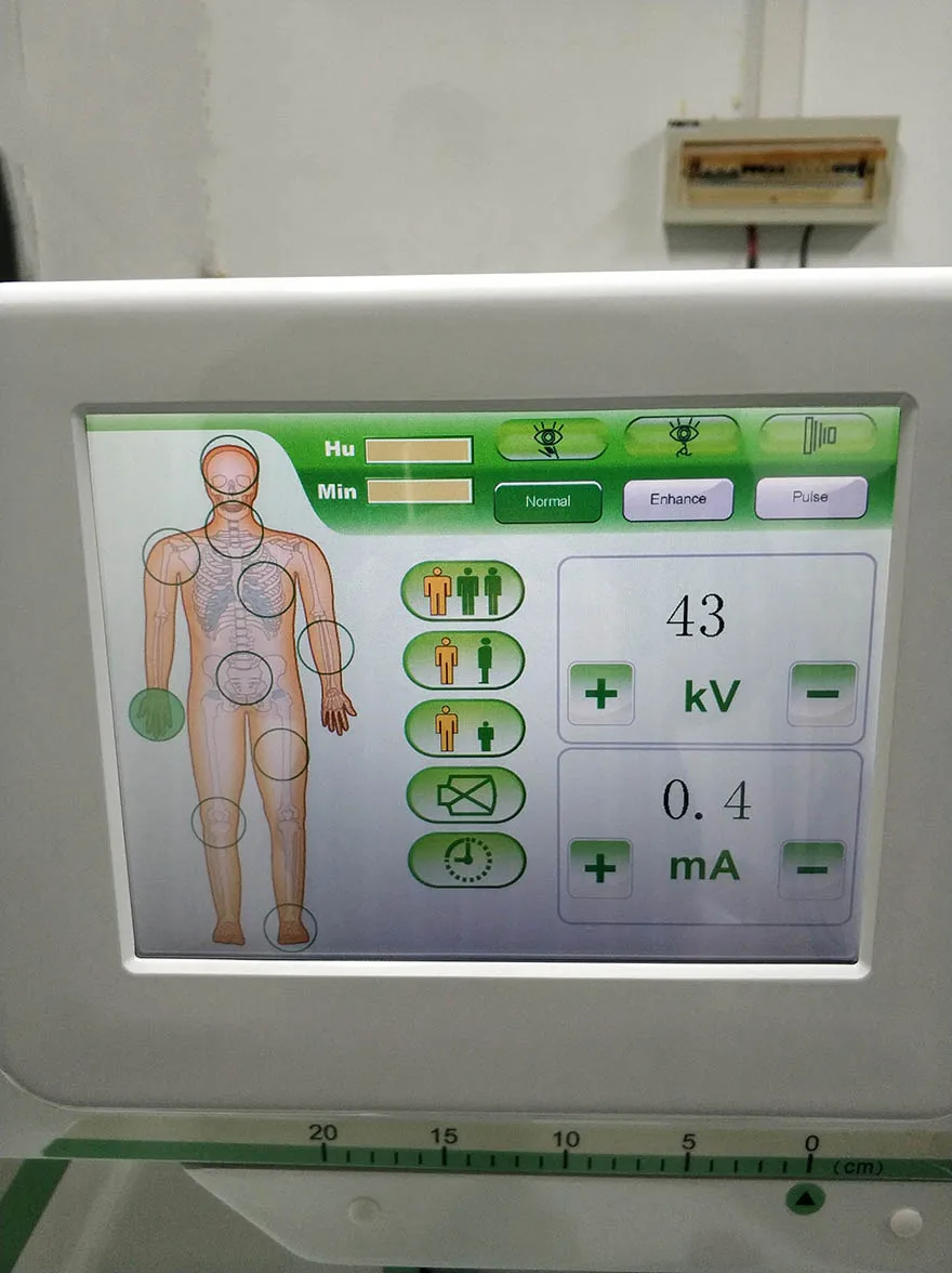 Hospital Angiography Vascular Surgery 6kw Mobile Digital C Arm X Ray ...