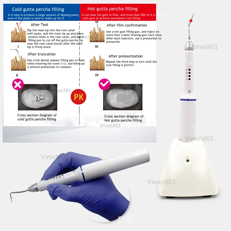 Dental Cutter Pen Endodontic Endo Gutta Percha Obturation Cordless Root ...