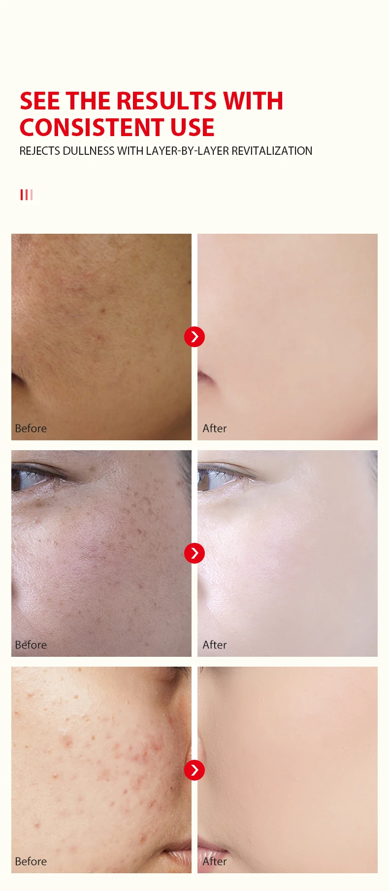 Private Label Glutathione Whitening Freckle Serum Remove Melasma Dark Spots Face Whitening Serum ...