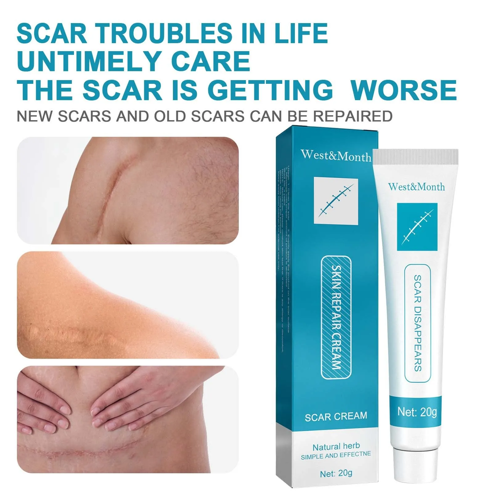 Private Label Acne Scar Removal Cream Effective Fade Old Scars ...