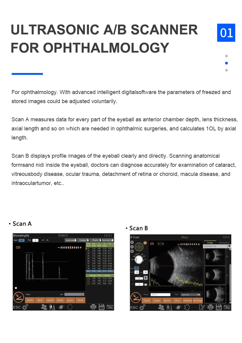 SJ Optics Ophthalmic Ab Scan Ultrasound Machine Ophthalmic Scanner ...