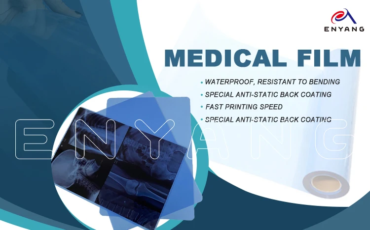 High Quality A4 Size Blue Inkjet Medical Film for X Ray Print