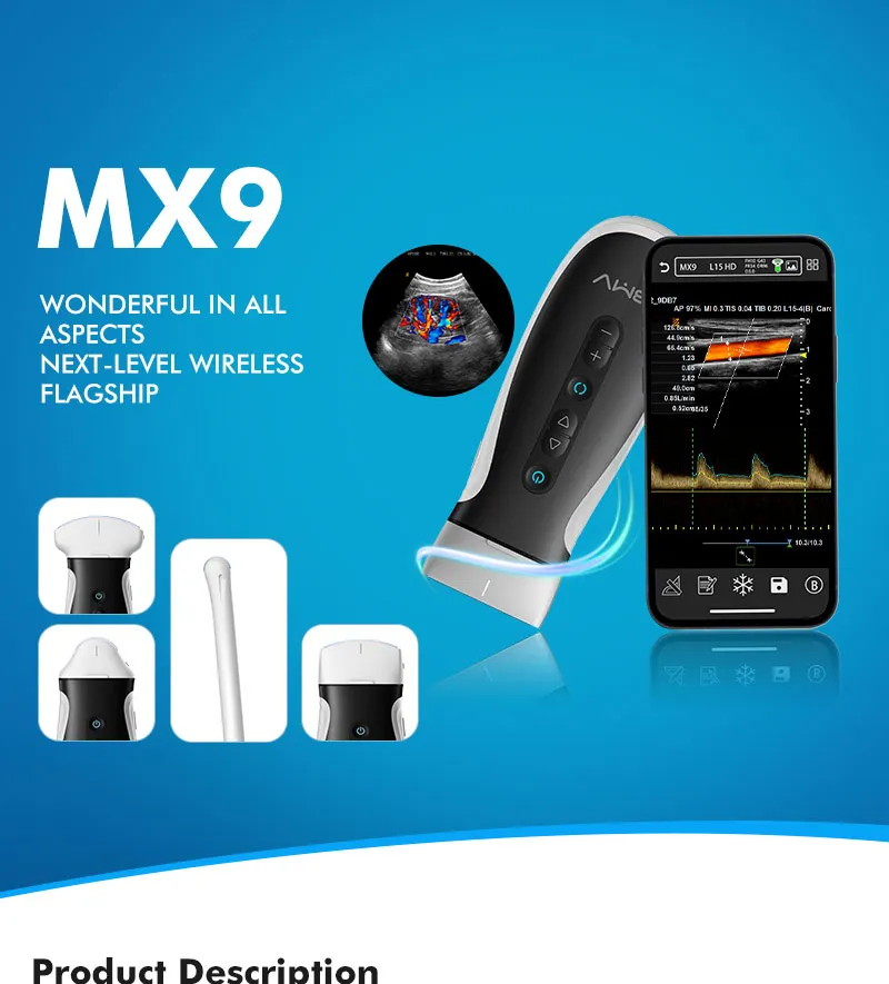 Wireless Smart Ultrasound Probe - BMV MX9 with B/W Color Doppler