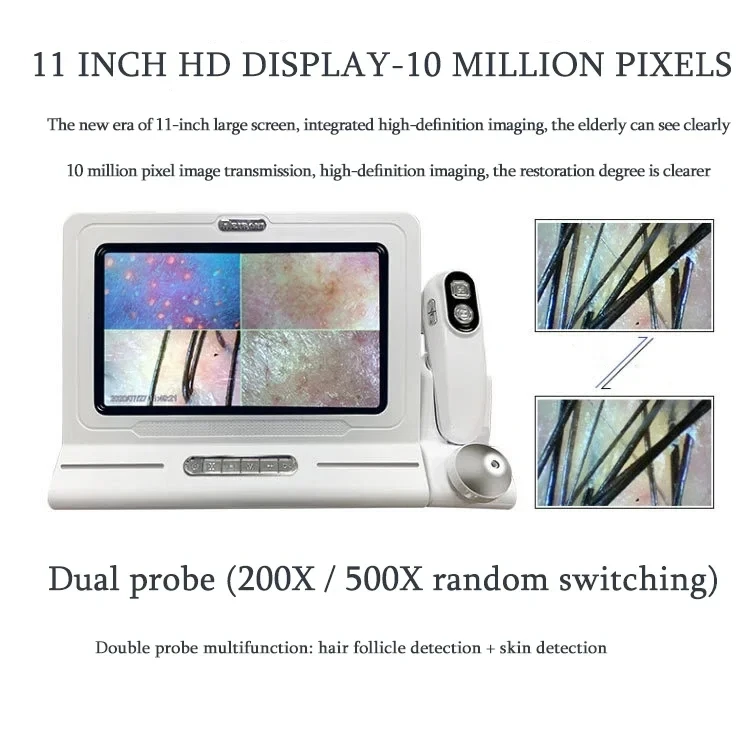 2024 Scalp Scanner Detector Hair Analyzer / Skin And Scalp Hair ...