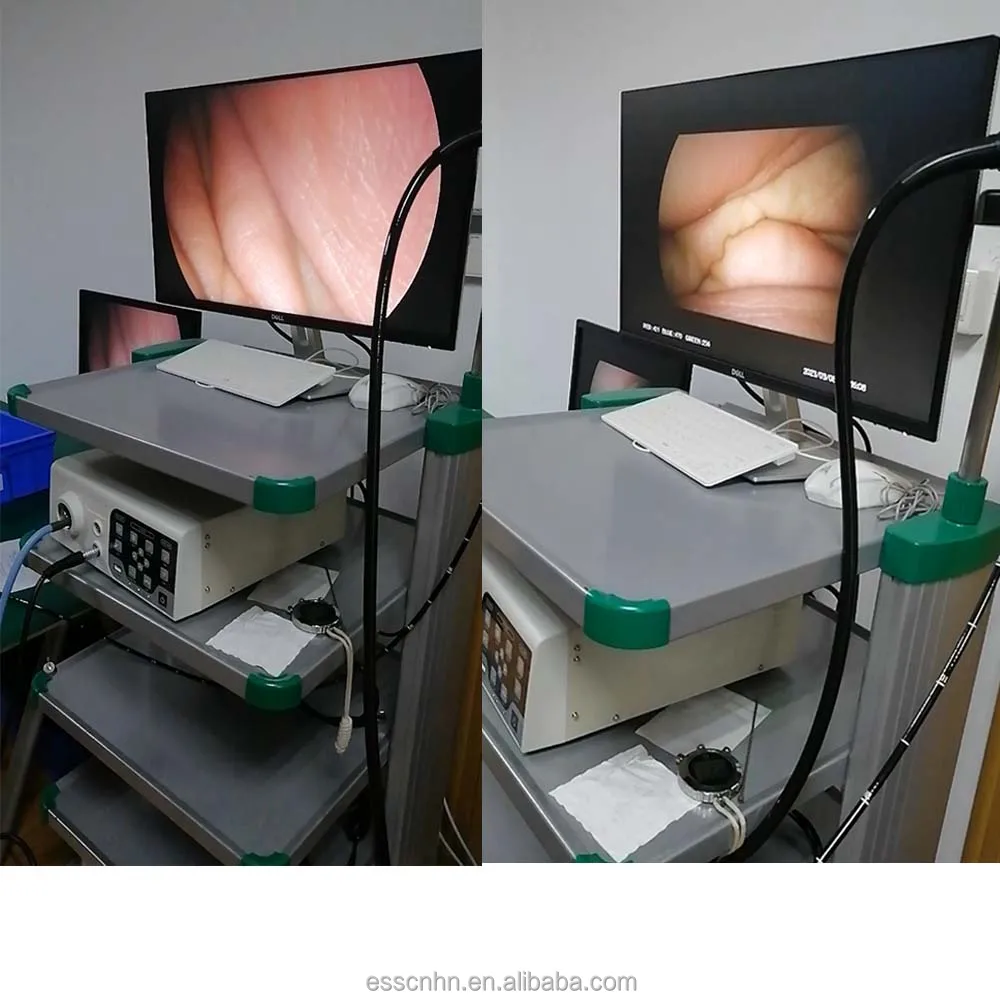 Medical Equipment Camera Laparoscope Gastroscope Endoscope Imaging ...