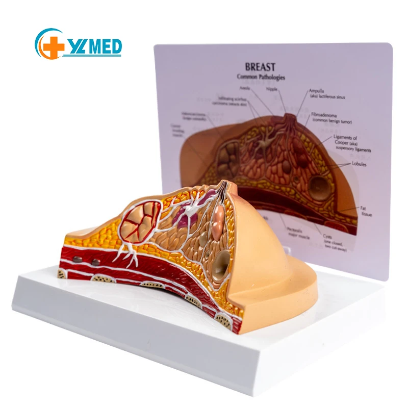 Gynecological Female Breast Anatomical Model - PVC Material