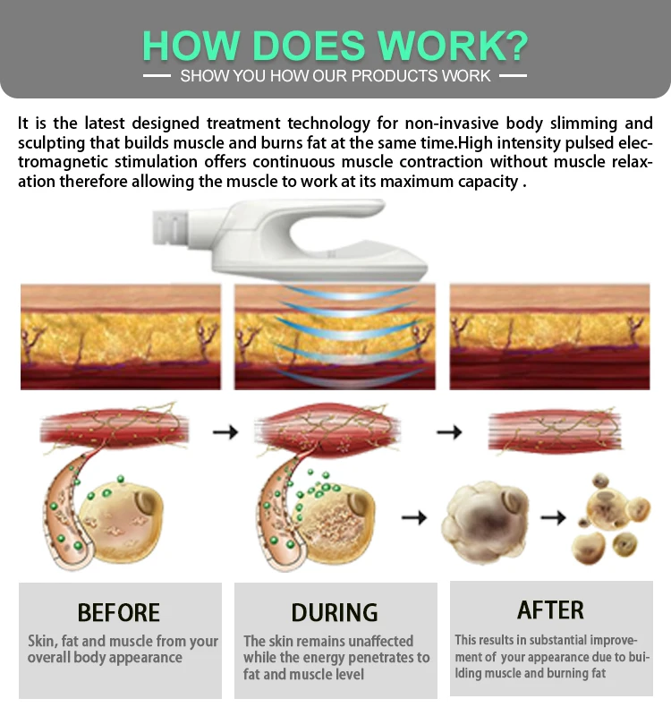 Em Tech Body Slim Neo Rf Pro Max Muscle Building Vertical Skin ...