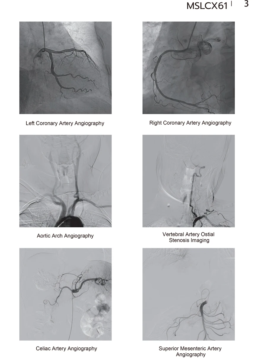 High-end Floor-Mounted Medical Angiography X-Ray System DSA C-arm