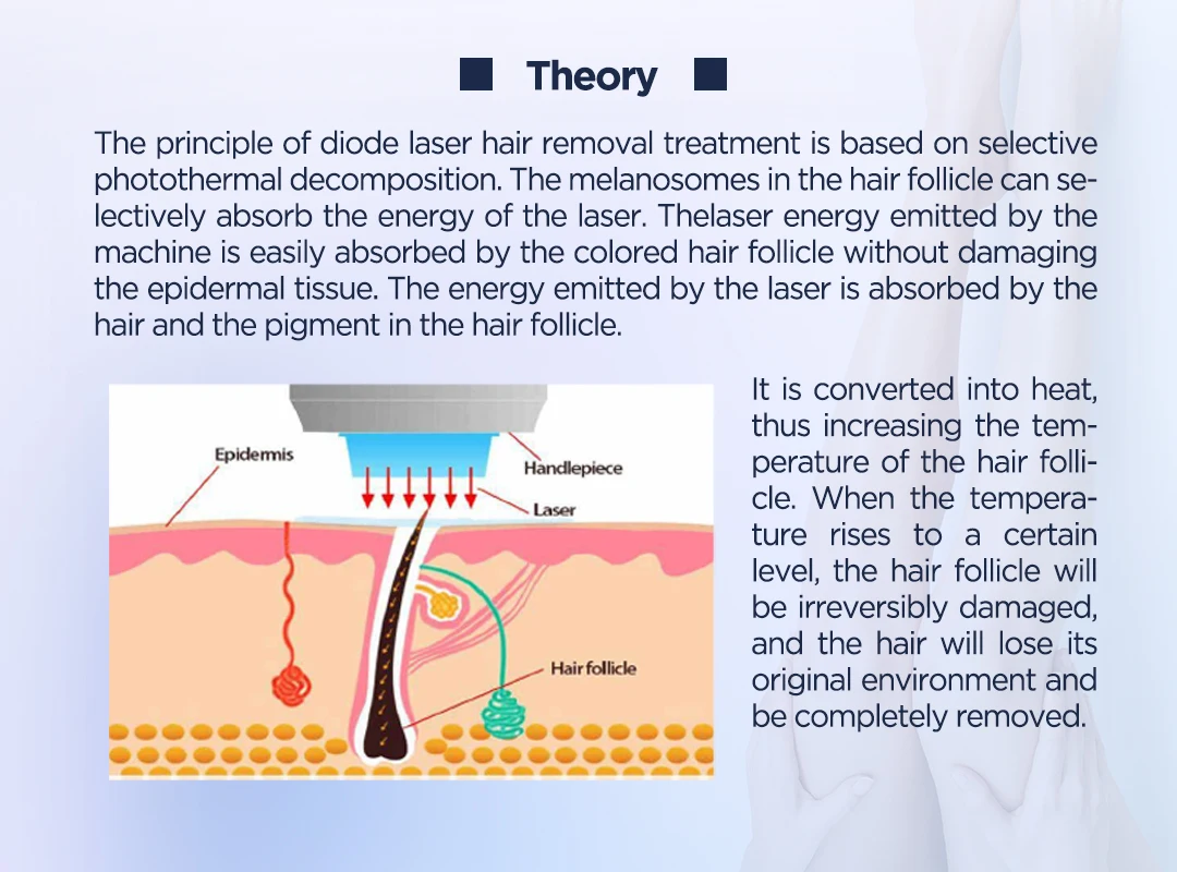 Adss Hot Selling Ice Alexandrite Laser Professional Diode Laser 755 808 ...
