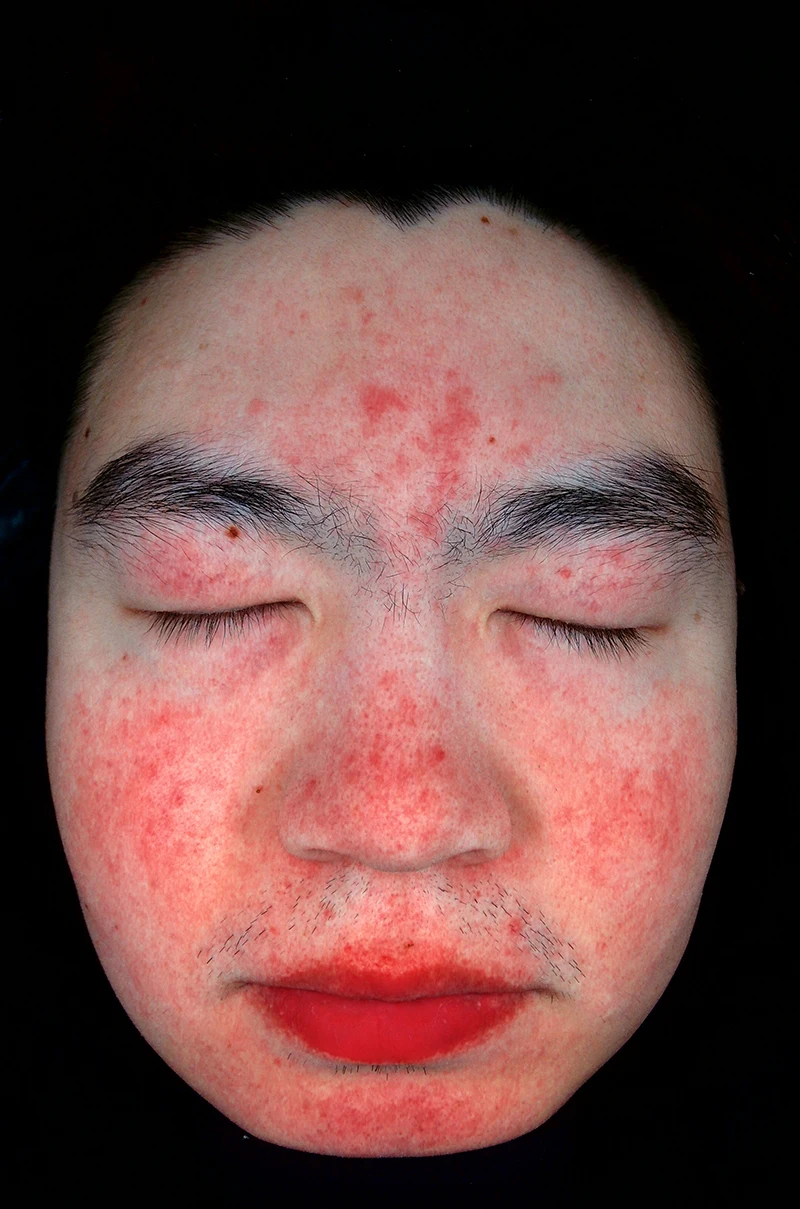 AIMYSKIN 3D Facial Skin Analysis Machine - Intelligent Scanner