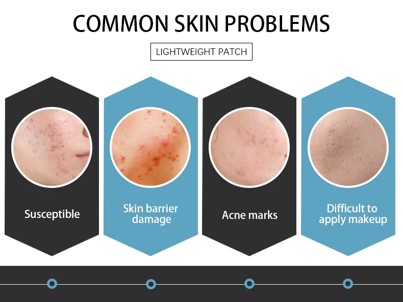 Micro Needling Pimple Patch - Best for Cystic Acne