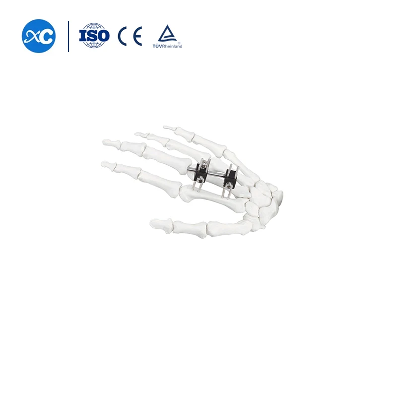 Professional Of-distal Radius Fixator B Wrist Joints Orthopedic Bone ...