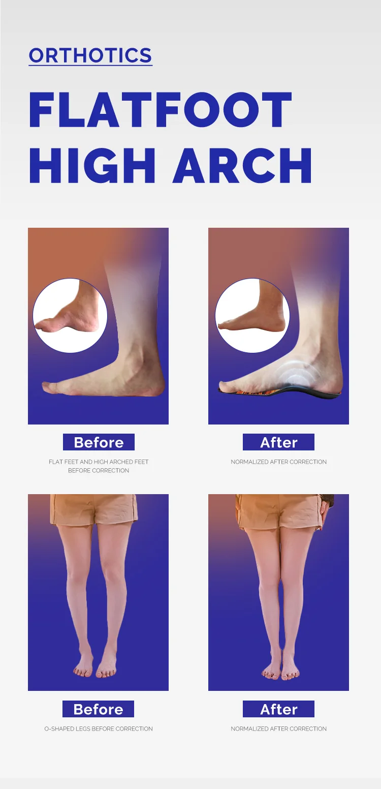 Orthesen Arch Support Heat Moldable Eva Macrowave Pre-heat Insoles Orthotic Oven Einlegesohlen ...