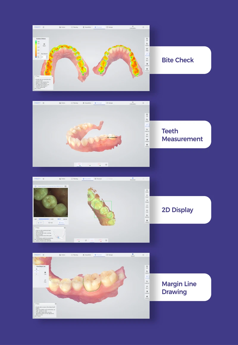 Dental Panda Intraoral 3d Scanner Digital Panda P2 Intra Oral Scanner ...