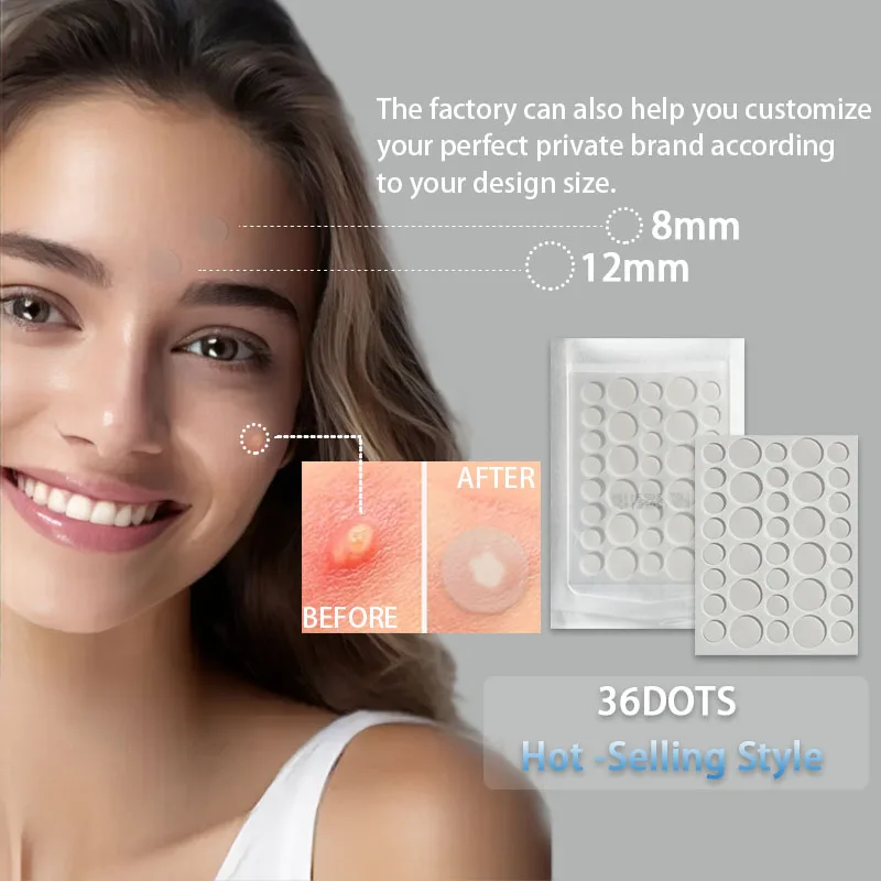 Factory Private Label Acne Patches Spot Treatment Sticker Hydrocolloid ...