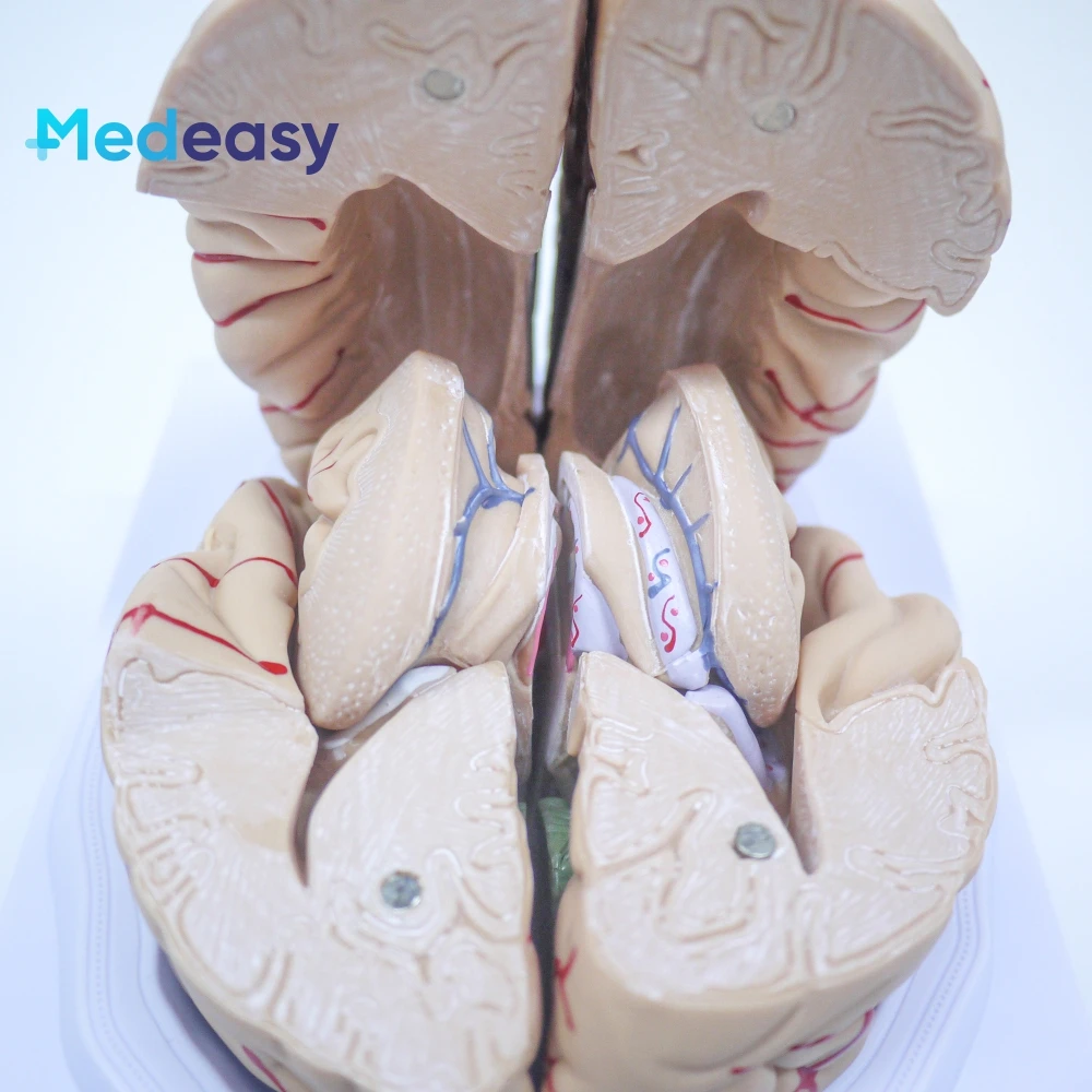 Brain Model, Brain Anatomy Model, Brainstem Model, Brain Structure ...